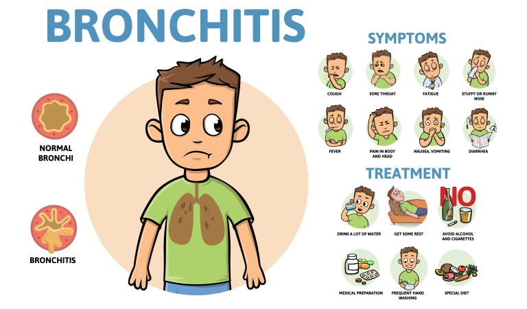 Ways to ease symptoms of bronchitis | Dr Batra’s™