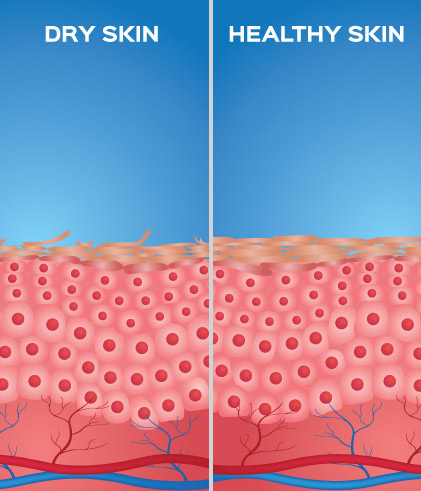 Dehydrated Skin: Causes, Symptoms & Best Treatment