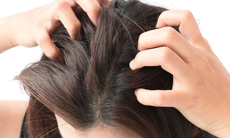 Home Remedies And Treatment For Itchy Scalp Dr Batras®