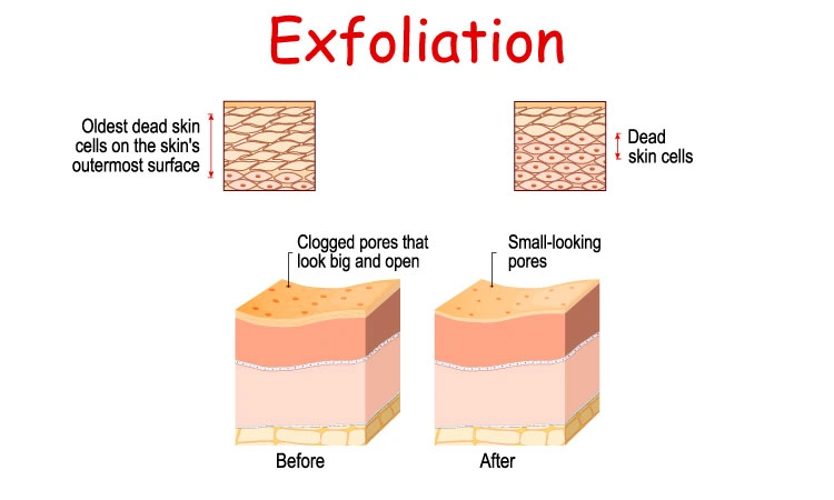 How to remove dead skin from face | Dr Batra’s®