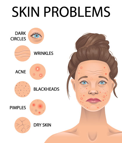 How psyche affects your skin health? | Dr Batra’s®