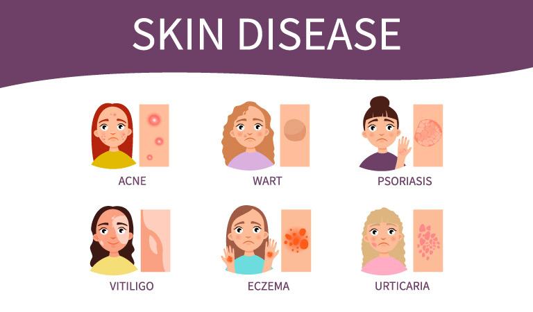 Skin disorders annoying you - Try homeopathy | Dr Batra’s®