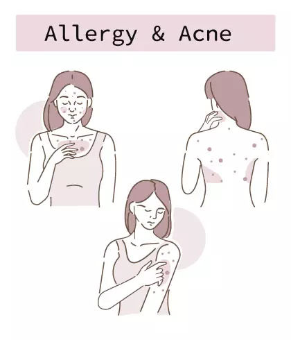 Reasons for whole body itching | Dr Batra’s™