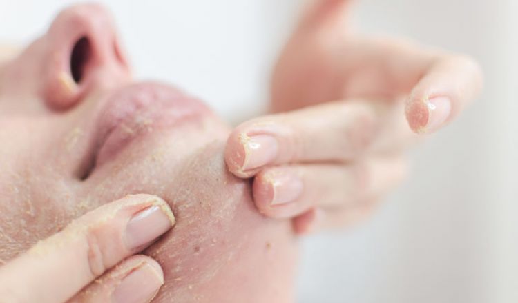 How to remove dead skin from face | Dr Batra’s®