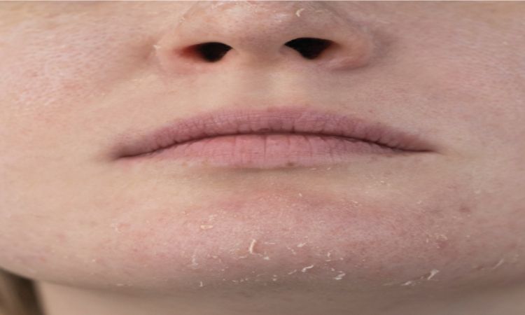 Are Purple Lips A Sign Of Dehydration | Lipstutorial.org