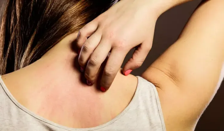 Itchy Skin What are the Reasons Dr Batra s