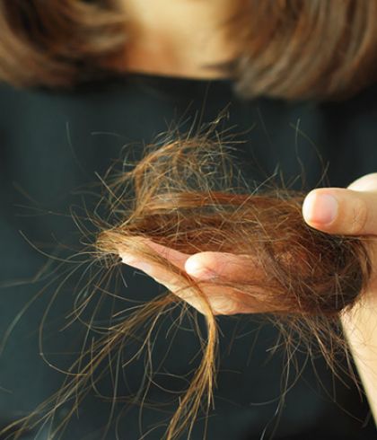 Things to do to stop your hair from falling out | Dr Batra’s™