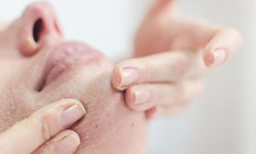 How to remove dead skin from face | Dr Batra’s™