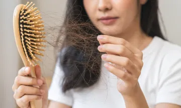Is castor oil good for alopecia areata? - Dr Batra’s®